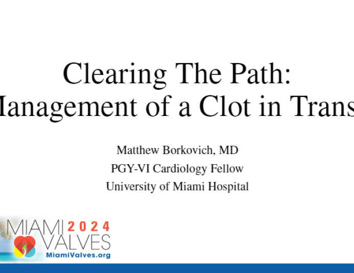 Clearing The Path: Management of a Clot in Transit | tctmd.com